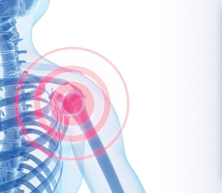 Frozen Shoulder; Causes, Symptoms, Treatments - The Center