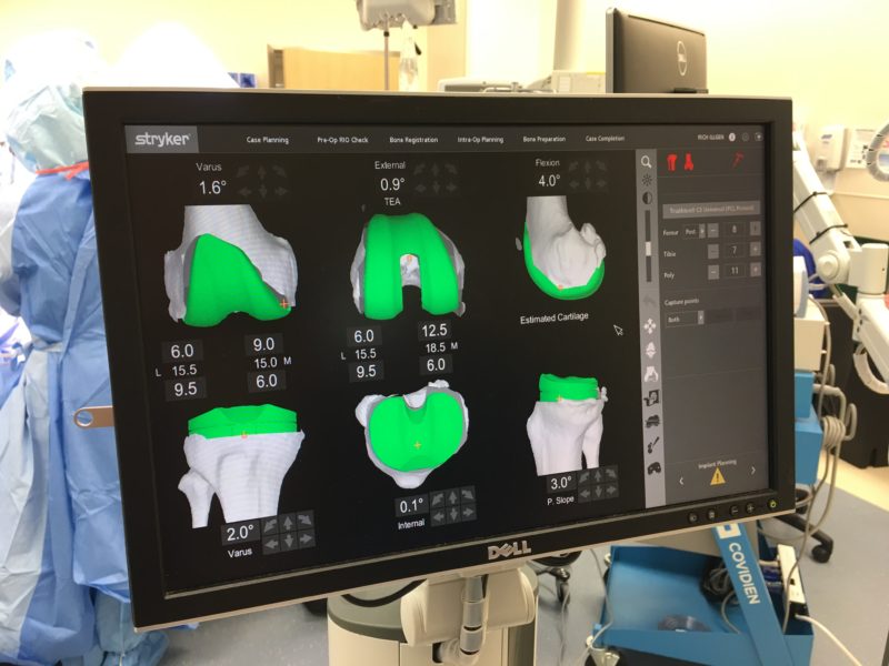Mako Robotic-Arm Surgery | Knee Replacement Surgery | Orthopedic Surgeons