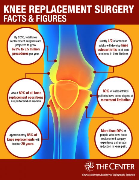 Knee Replacement Surgery By The Numbers | The Center