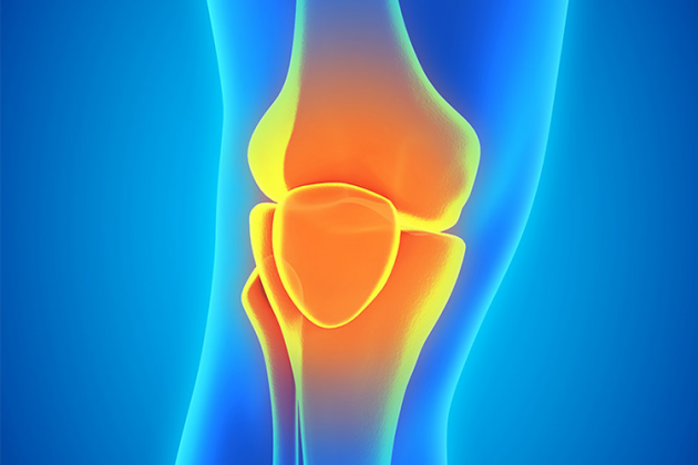 Knee Replacement Surgery By The Numbers | The Center