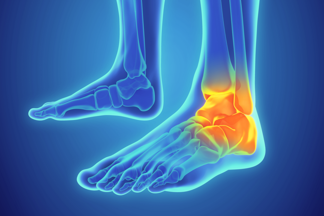 Total Ankle Replacement - Ankle Replacement Surgery - Foot Ankle Surgery