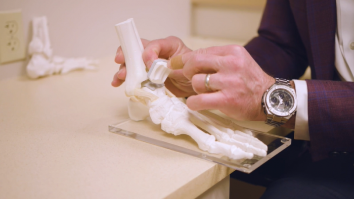 Total Ankle Replacement | Orthopedic Surgeons in Bend, OR