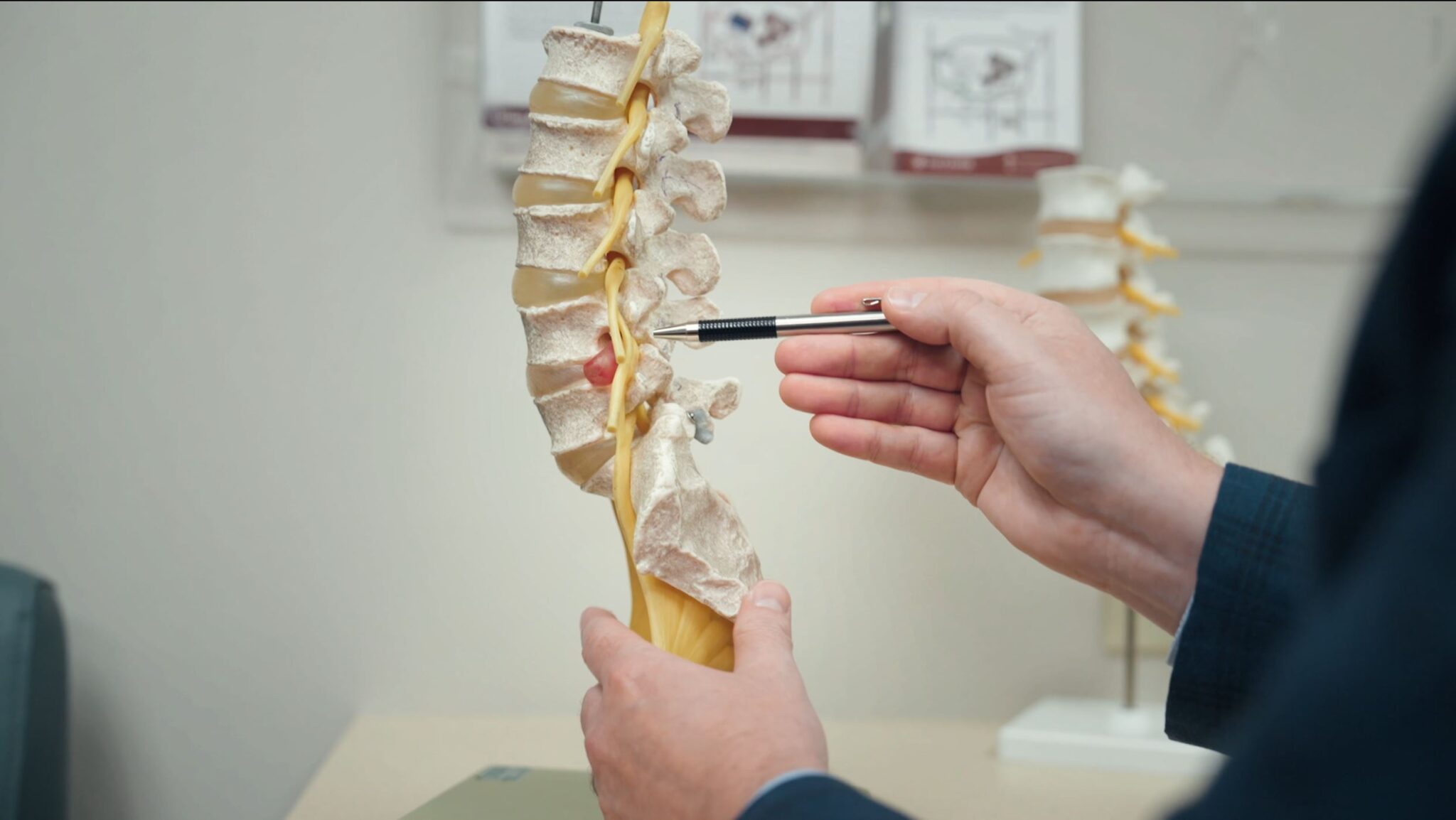 Understanding Herniated Disks | The Center